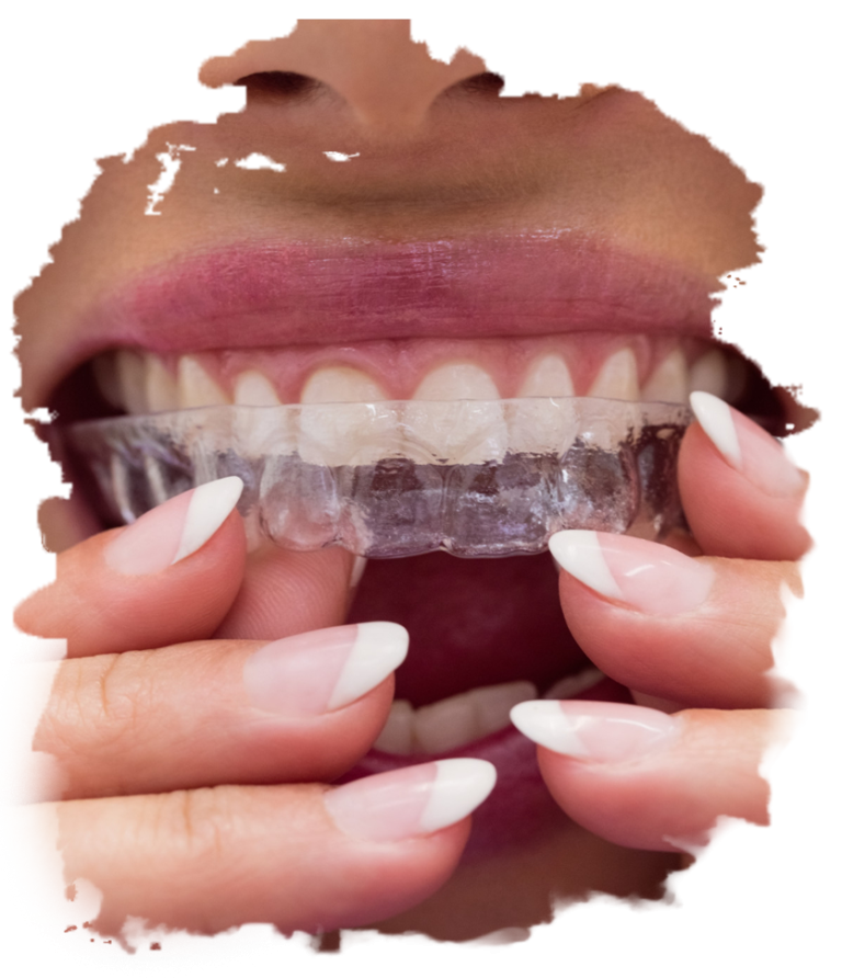 Was ist Splint? Für wen ist sie geeignet? - Dr. Birkan Duras